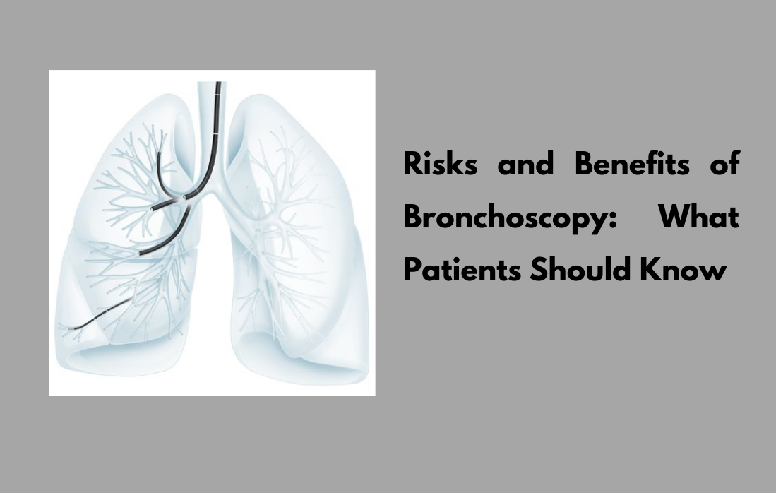 Risks and Benefits of Bronchoscopy: What Patients Should Know